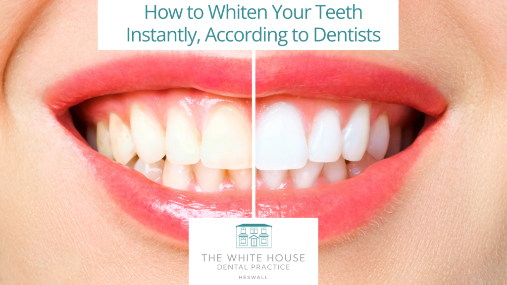How To Whiten Your Teeth Instantly, According To Dentists - Heswall ...